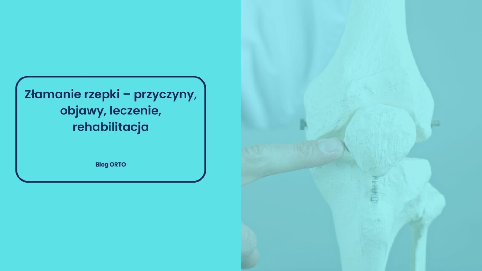 Złamanie rzepki – przyczyny, objawy, leczenie, rehabilitacja | Blog orto.pl